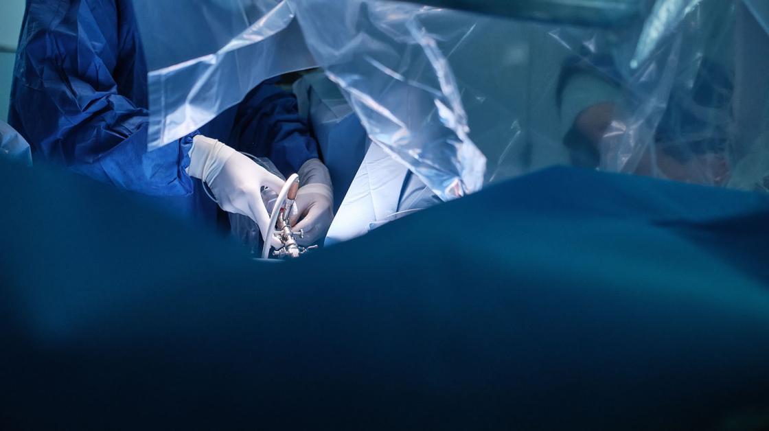 Urologie : en quoi consiste la sonde urinaire en double J